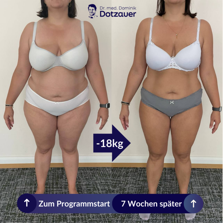 Dieser Eine Trick Verbrennt 1 Kg Bauchfett Uber Nacht Die Wahrheit Hinter Dem Hypefeed